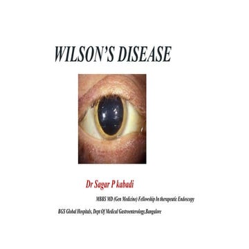 Wilson's Disease Dr Sagar | PPT