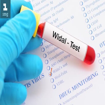 Widal Test for Enteric Fever | PPT