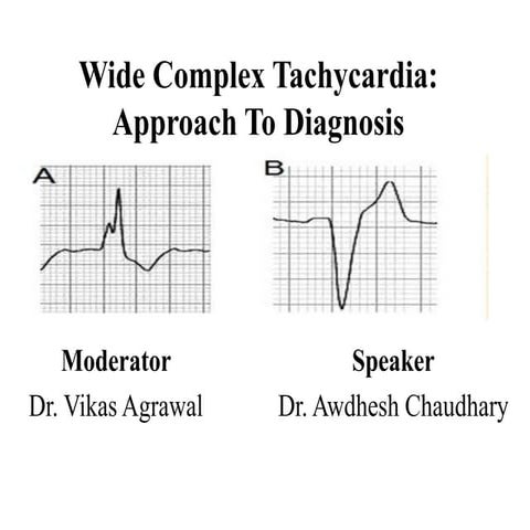 Approach to Wide complex tachycardia /cardiology | PPTX
