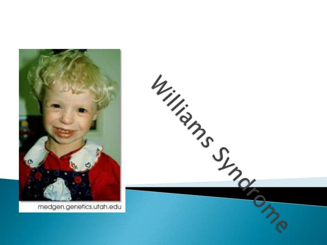 Williams Syndrome Pptx