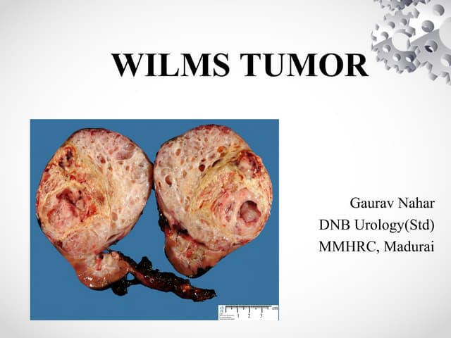 Wilms Tumor Ppt