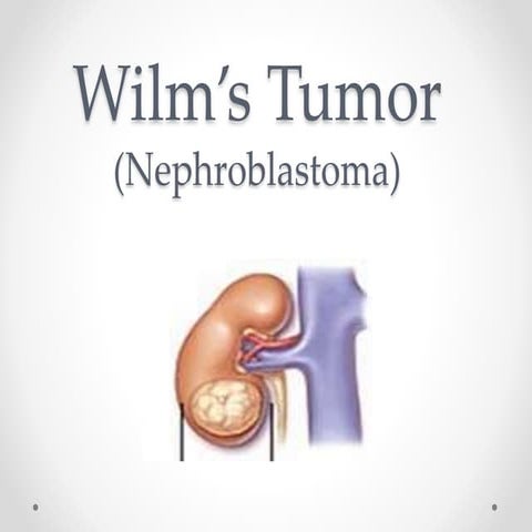 Wilm's tumor.pptx