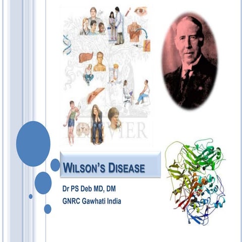 Wilson’s disease | PPTX