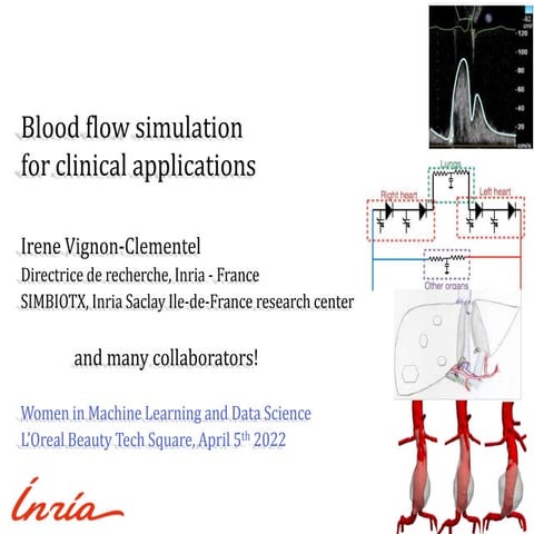 "Blood flow simulation for clinical applications" by Dr Irene Vignon ...