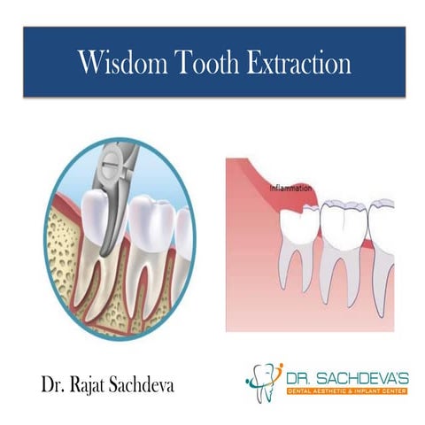 Wisdom Tooth Extraction | Dental Courses in India | PDF