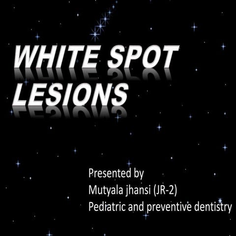 White Spot Lesions Pptx 4508