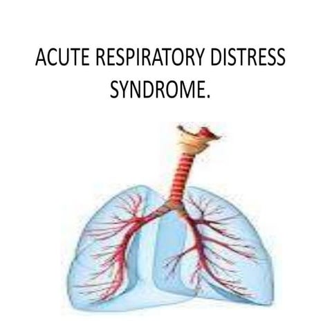 Acute respiratory distress syndrome | PPTX