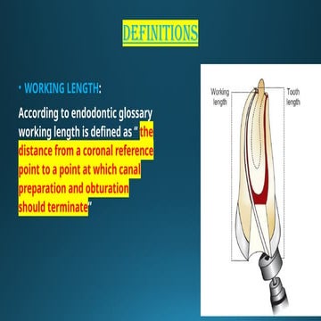 Working length determination | PPT