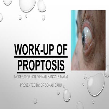 Work up of proptosis.pptx a useful one . | PPTX | Thyroid Disorders | Endocrine and Metabolic ...
