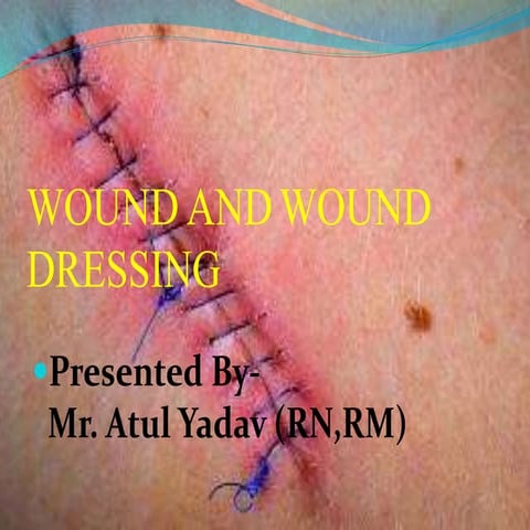Wound dressing | PPTX