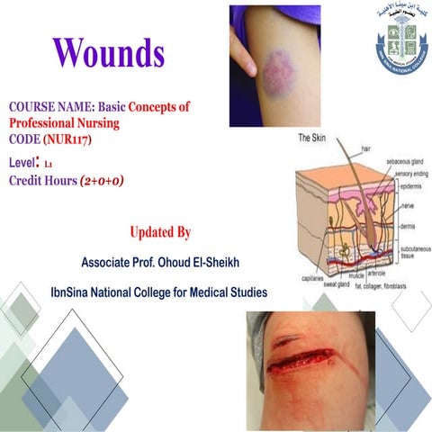 wound-and healing process /Dr.Ohoud.pptx