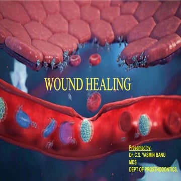 WOUND HEALING. wound healing in general, wound healing in dentistry. | PPTX