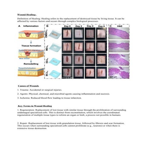 wound healing - General Surgery Definition, stages, classification | DOCX