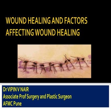 Wound Healing for UG.pptx