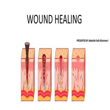 Wound_Healing_Full_Presentation and phases of wound healing.pdf