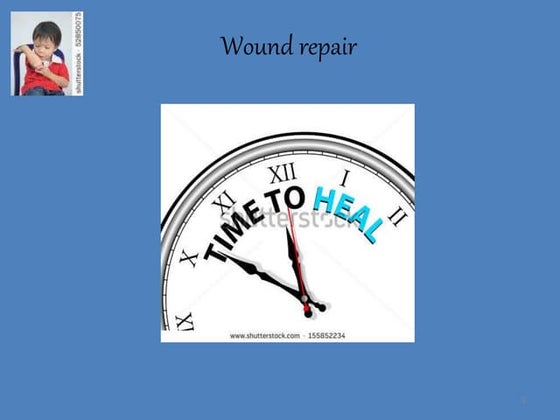 Wound care | PPT