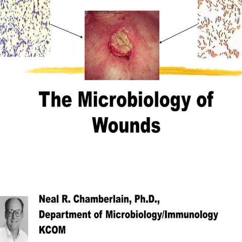 wound infection microbiology.PPT
