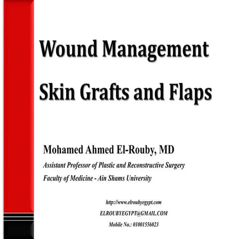 Efficacy of Injectable Collagenase in the treatment of Dupuytren’s ...
