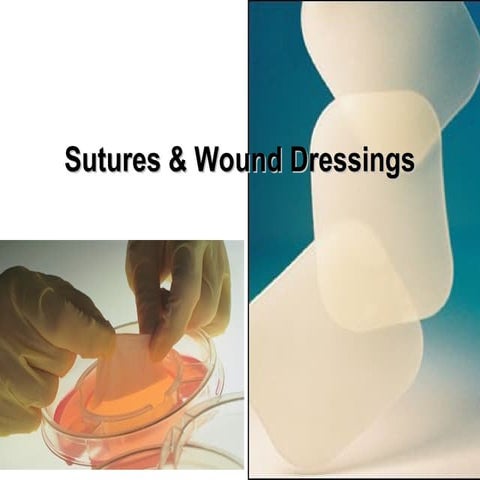 Management of surgical wound | PPTX