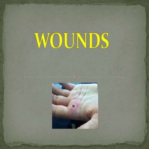 Wounds | PPT