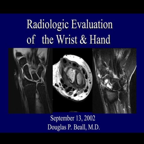 Wrist MRI Magnetic Resonance Imaging.ppt