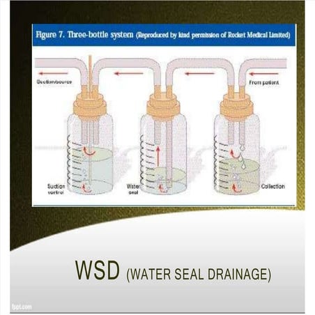 Tatalaksana WSD.pptx