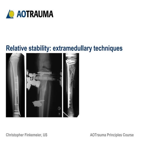 Relative extramedullary stability | PPT