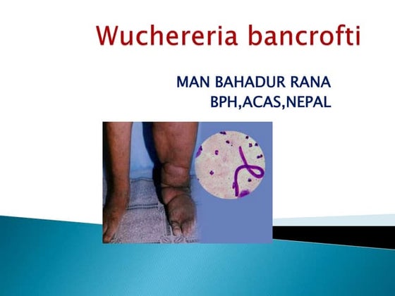 Classification of Microfilaria | PDF