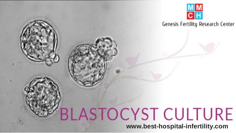 Blastocyst Embryo Transfer In Tamil Nadu Infertility Specialist In blastocyst-embryo-transfer-in-tamil-nadu-infertility-specialist-in