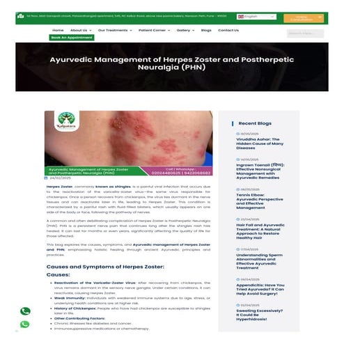 Ayurvedic Management of Herpes Zoster and Postherpetic Neuralgia (PHN ...