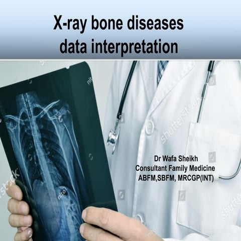 X ray bone disease data interpretation | PDF | Death, Injury, or ...