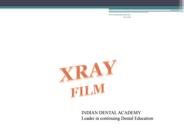 Dental X-Ray Film types and indications. | PPTX