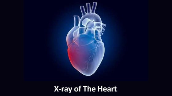 The boot shaped heart sign | PPT