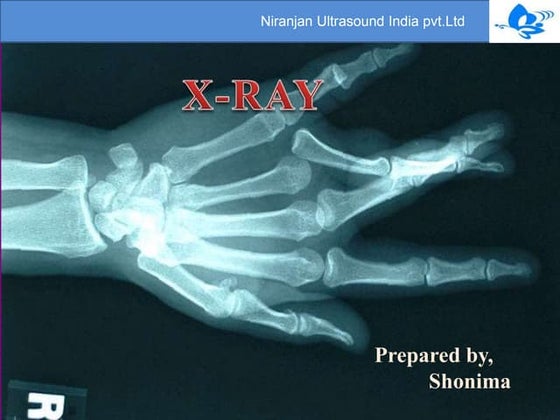 X Rays Ppt | PPT