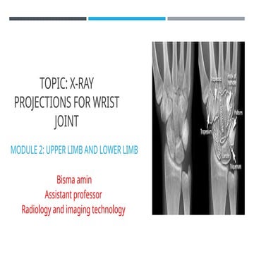radiography positioning of knee and leg | PPTX