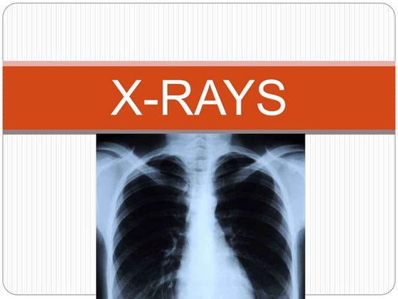 X Rays Ppt | PPT