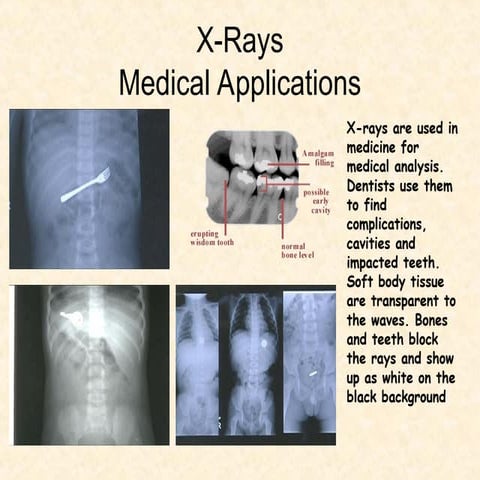 Mr. ali mushtaq chest and other X-Rays uses.ppt