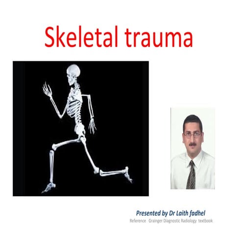 Skeletal trauma | PPT