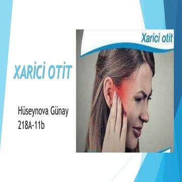 xarici otit.hg-1.pptx
