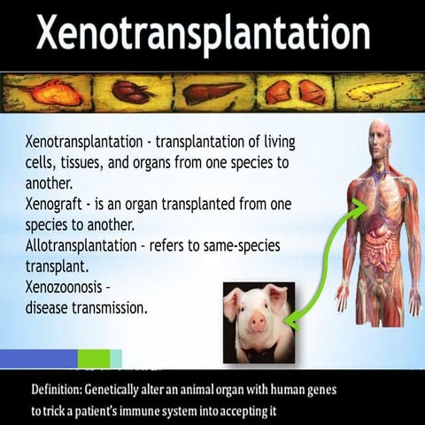 Xenotransplantation | PPTX
