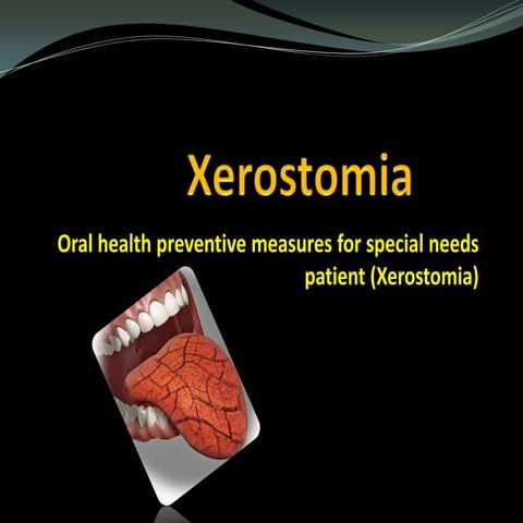 Xerostomia | PPTX