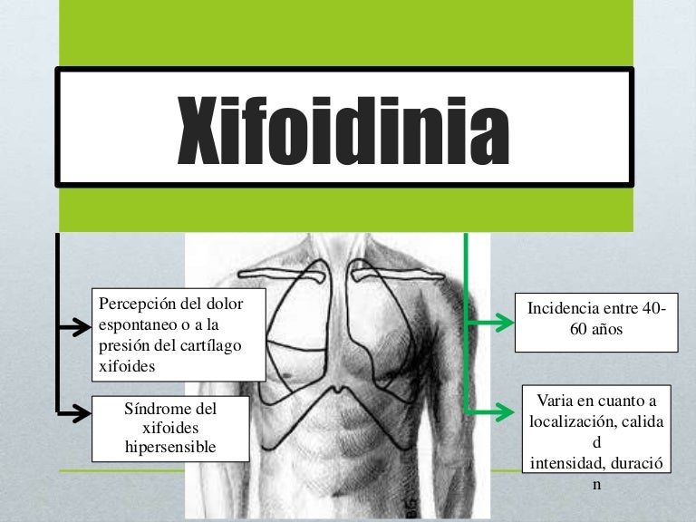 Xiphoid Process Pain Xiphoidalgia The Ultimate Guide