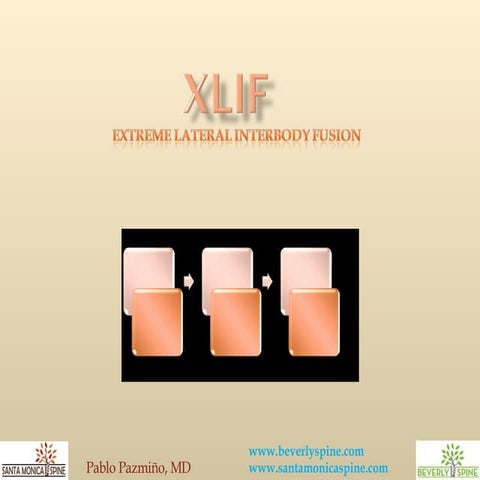 XLIF by Pablo Pazmino MD | PPT