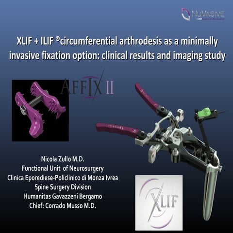 XLIF + ILIF ®circumferential arthrodesis as a minimally invasive | PPT