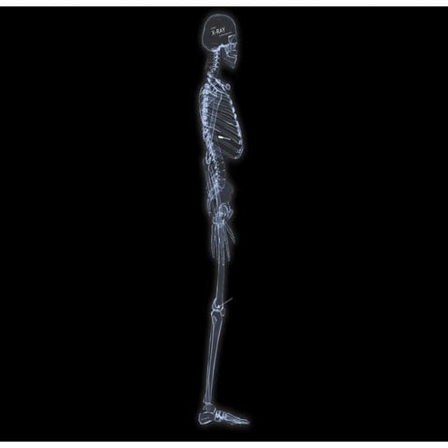 X-RAY of the Body | PPT