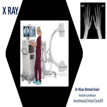 X-Ray | PPTX