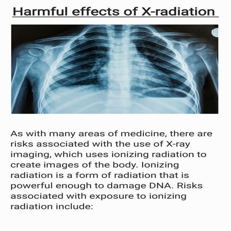 X ray.pdf