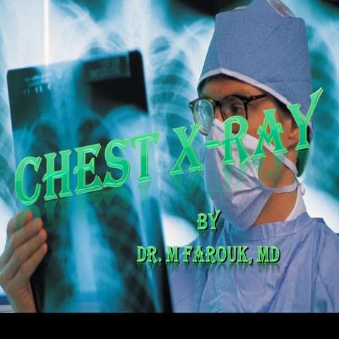 X ray basics of chest radiological findings.pdf