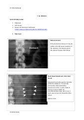 Signs of Pneumoperitoneum on Plain Film | PPT