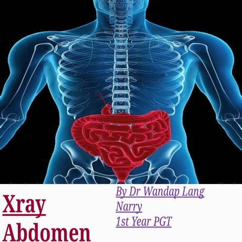 abdominal x ray radiology | PPTX